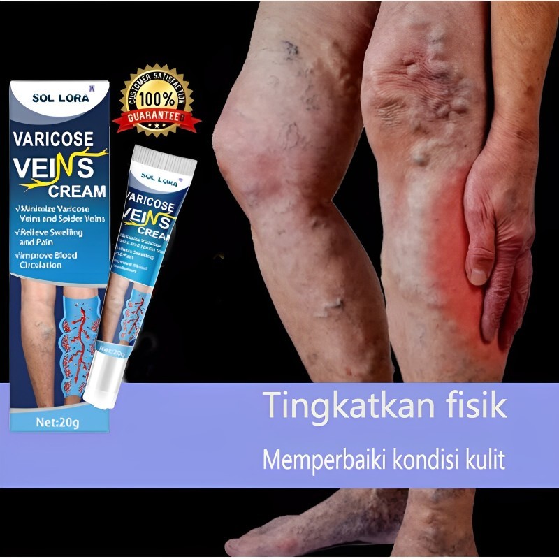Jual Obat varises kaki Salep varises 20g salep laba-laba Vaskulitis ...