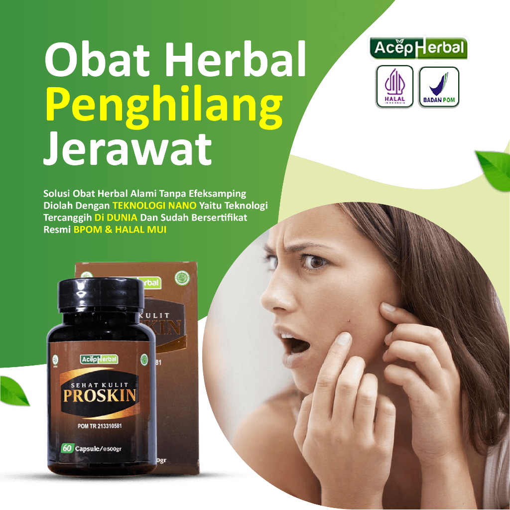 Jual Obat Penghilang Jerawat Flek Hitam Gatal Bintik Merah Untuk ...