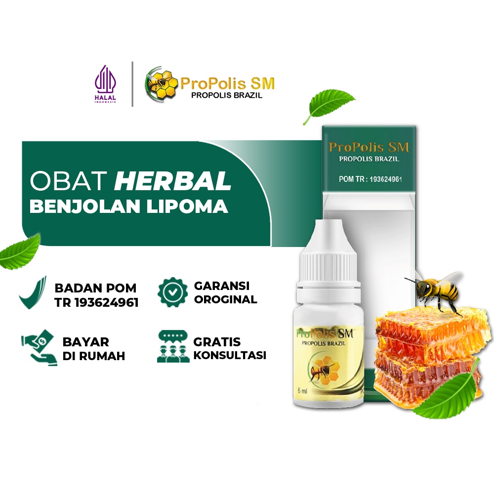 Jual Propolis Sm Herbal Obat Penghancur Benjolan Lipoma isi 6ml ...