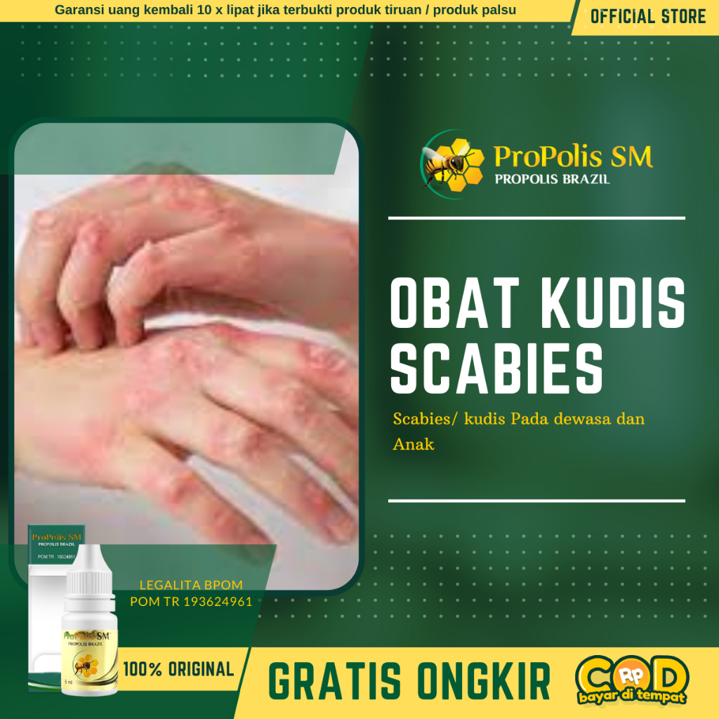 Jual Obat salep Scabies Anak anak dan dewasa, salep Kulit Scabies ...
