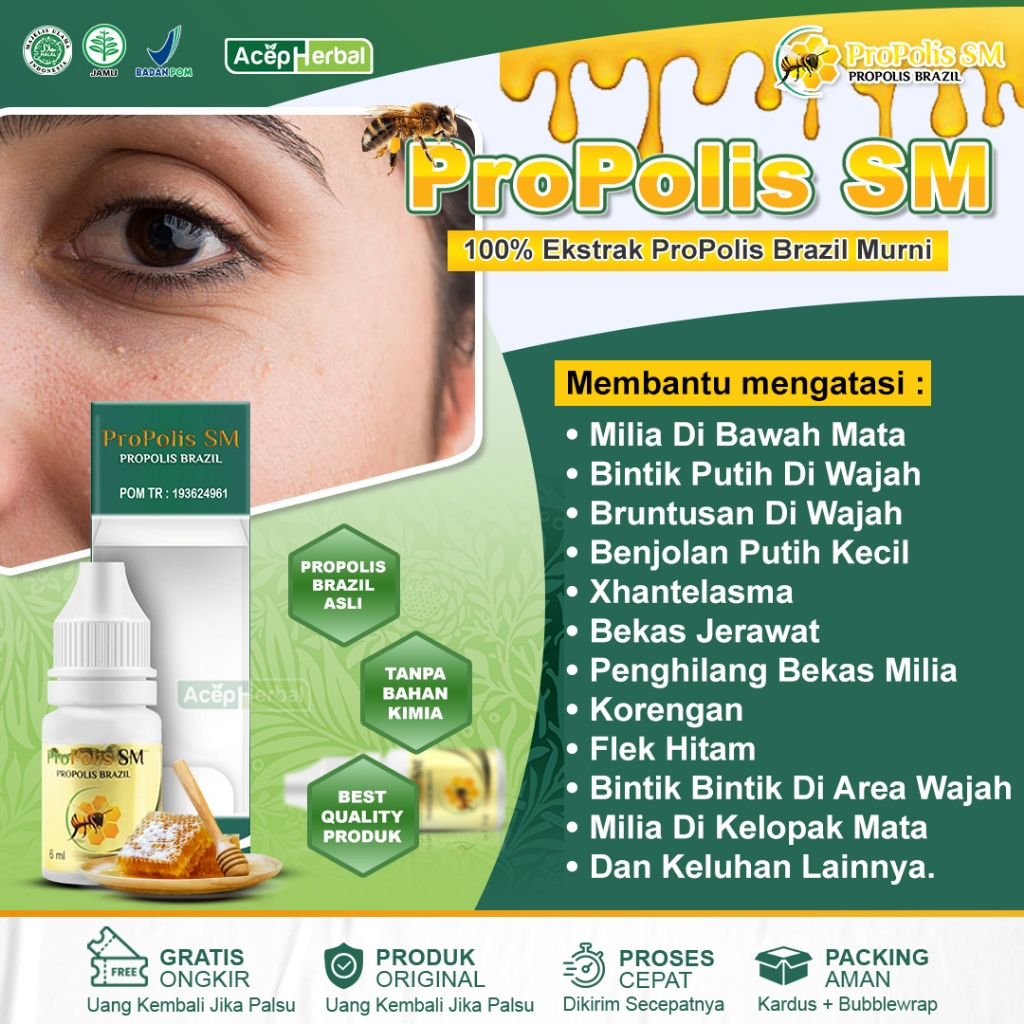 Jual Obat Milia Di Bawah Mata Penghilang Milia di Wajah Bintik Putih di ...