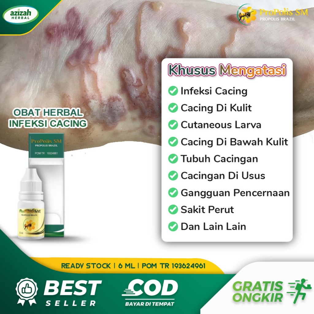 Jual Obat Cutaneous Larva Migrans Cacing Kulit Infeksi Larva Cacingan ...