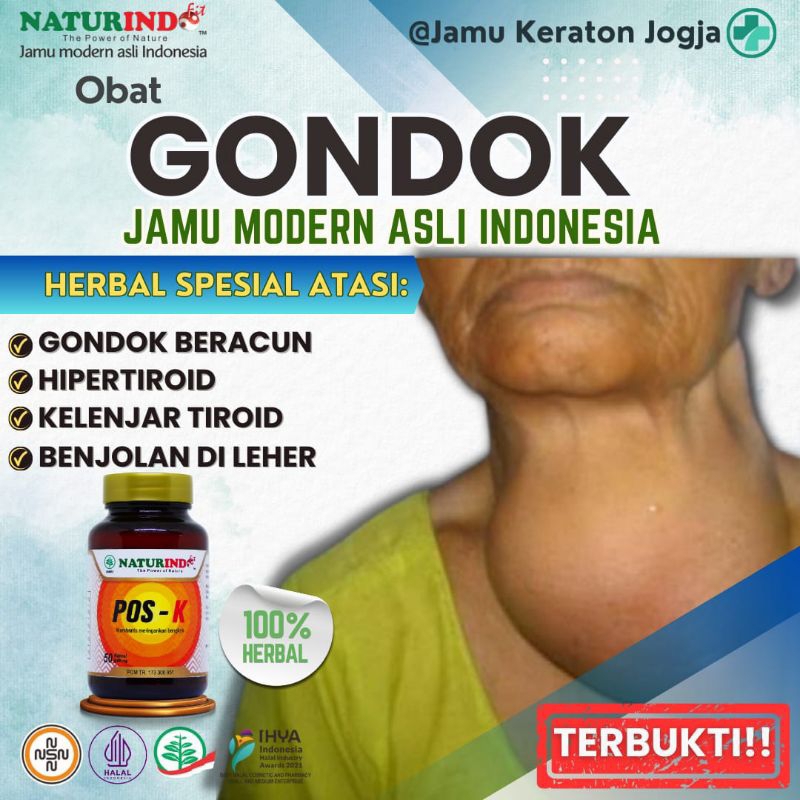 Jual Obat Gondok Hipertiroid Benjolan Dileher Tumor Kelenjar Tiroid ...