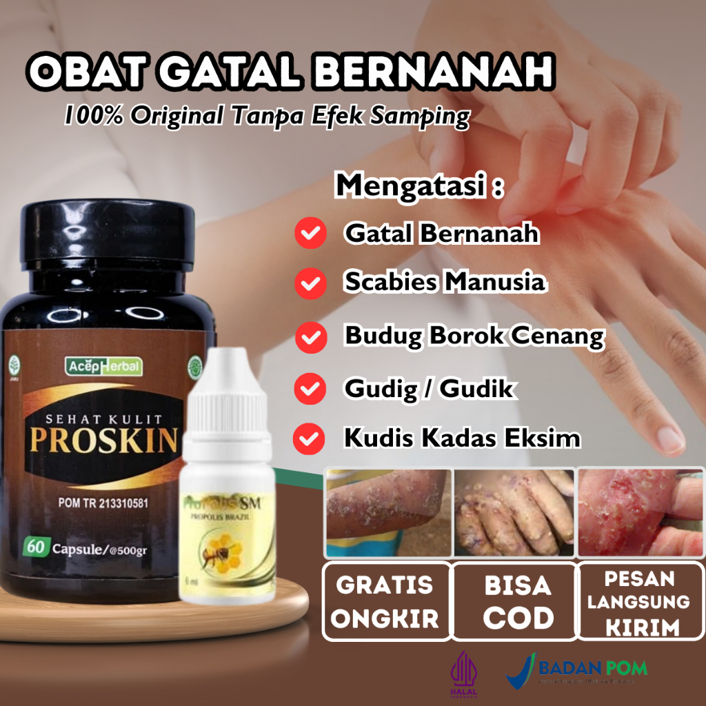 Jual Obat Scabies manusia, Penghilang Ruam Kulit gatal di badan, Obat ... Jual Obat Scabies manusia, Penghilang Ruam Kulit gatal di badan, Obat ...
