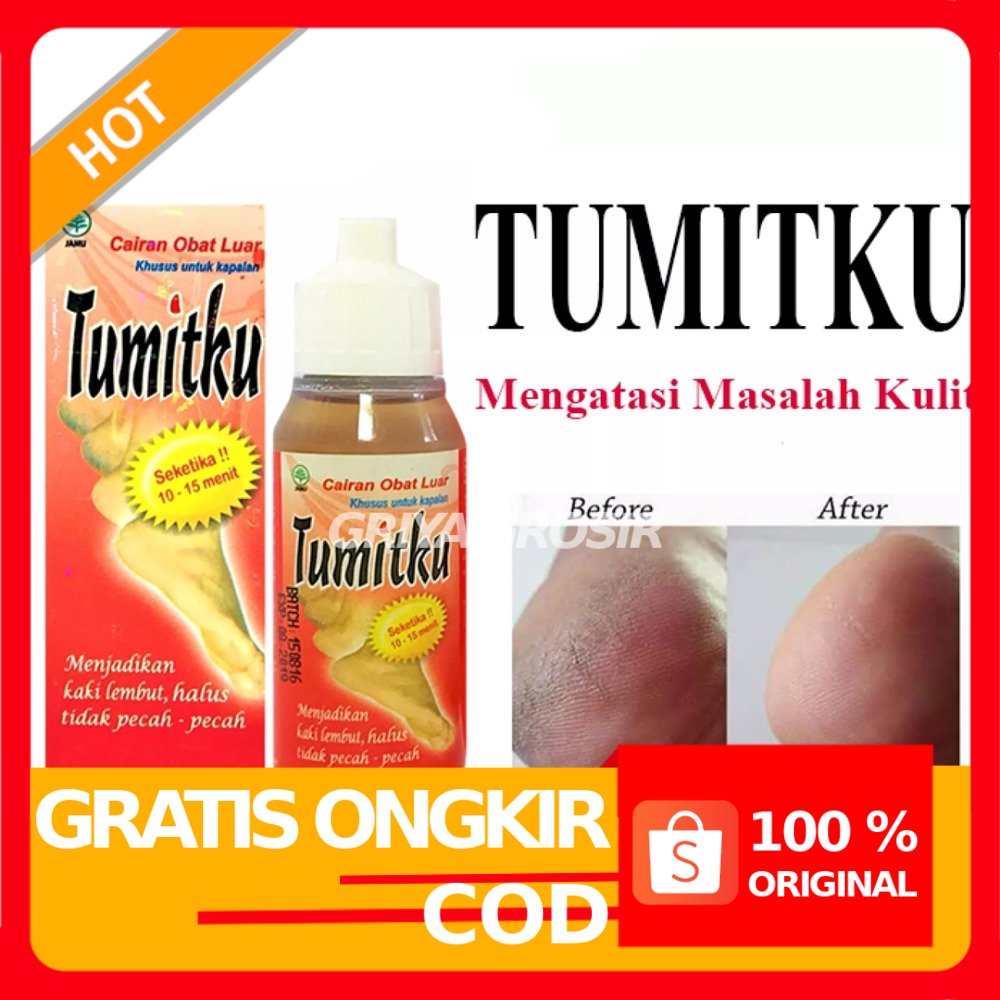 Jual TUMITKU 30ML ASLI ORIGINAL SOLUSI KULIT KAKI TUMIT KASAR PECAH ...