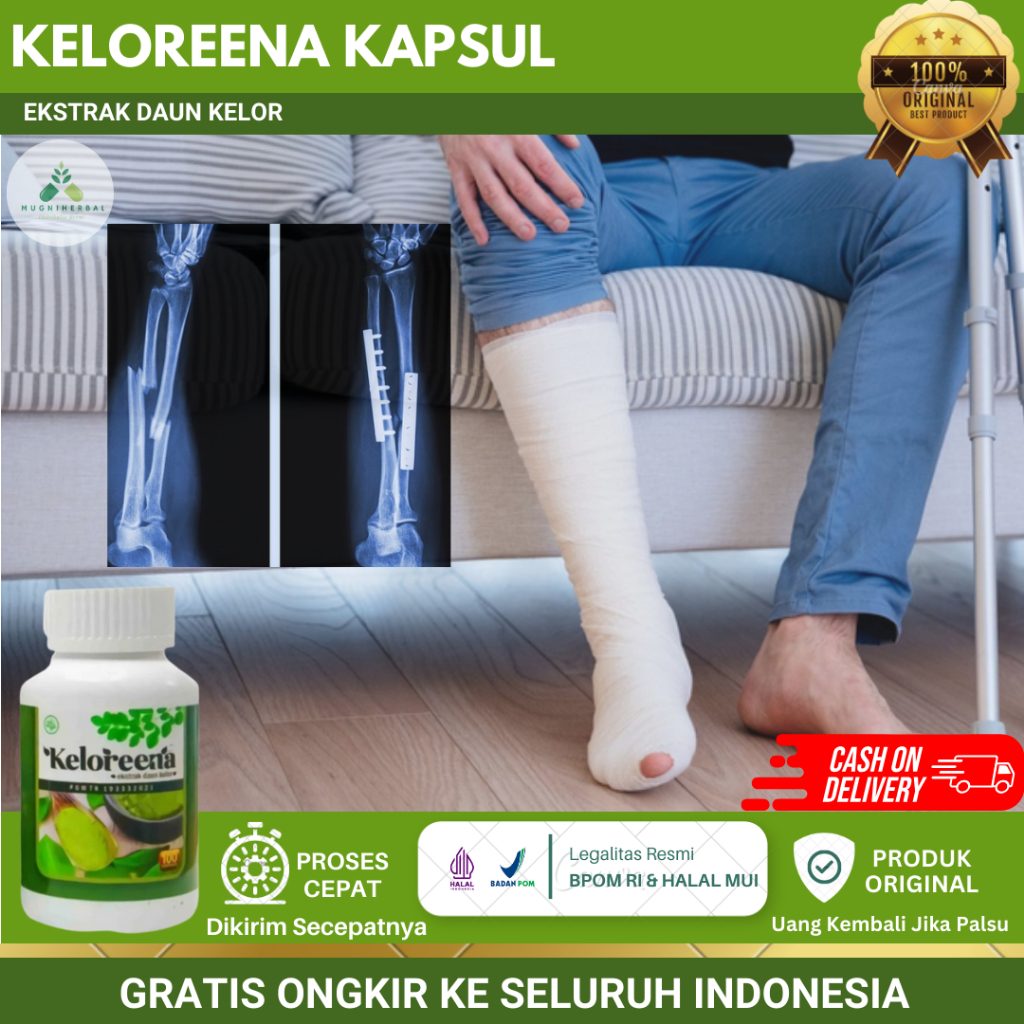 Jual Keloreena Kapsul 100% Original - Obat Patah Tulang, Patah Tulang ...