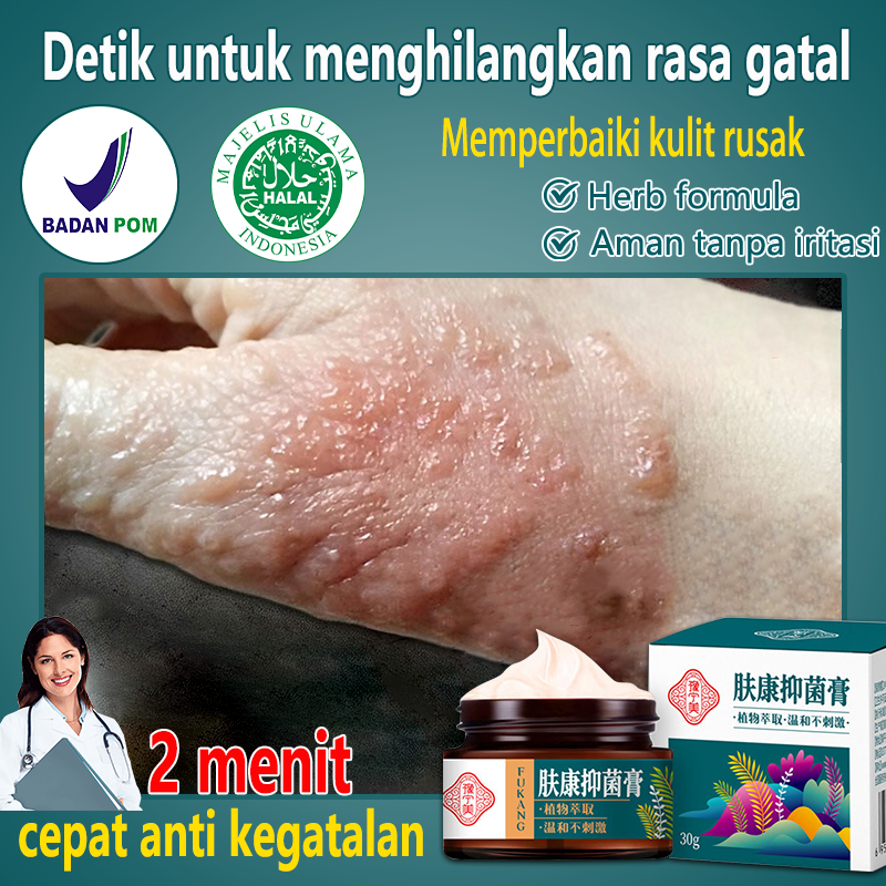 Jual (100% ORI)Obat alergi gatal kulit Salep gatal paling ampuh Salep ...