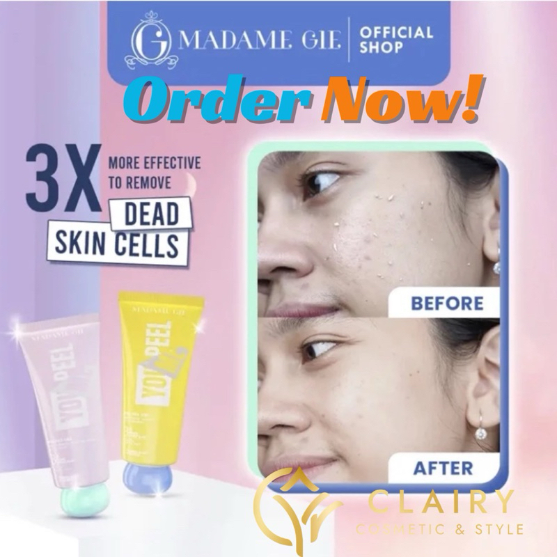 Jual MADAME GIE PEELING GEL 100ml made korea keren buat peeling muka ...