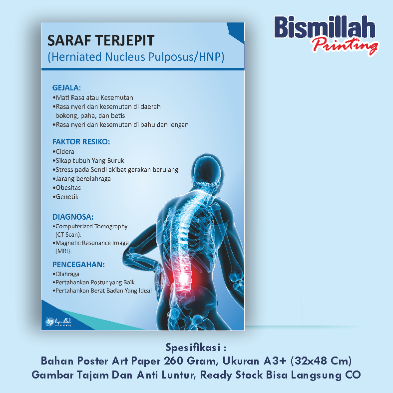 Jual Poster Kesehatan Saraf Terjepit | Shopee Indonesia
