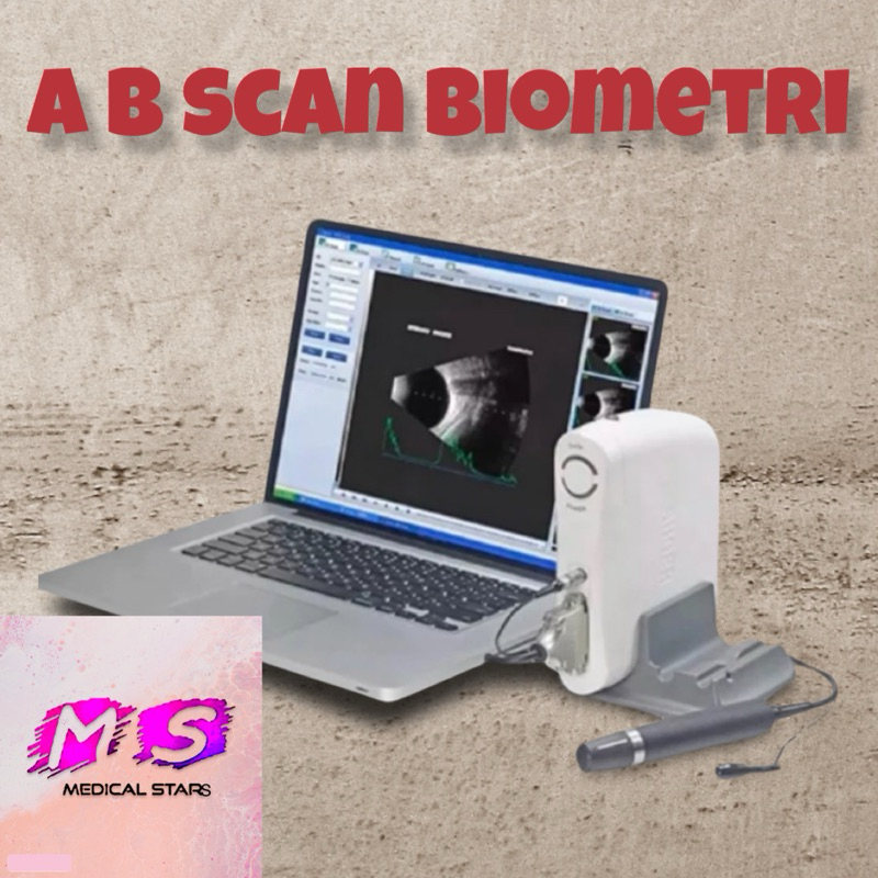 Jual Usg mata| AB scan| biometri| AB scan biometri mata | Shopee Indonesia