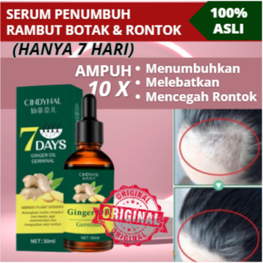 Jual Penumbuh Rambut Botak Dan Rontok Pria Anak Bayi Balita Cepat Serum ...