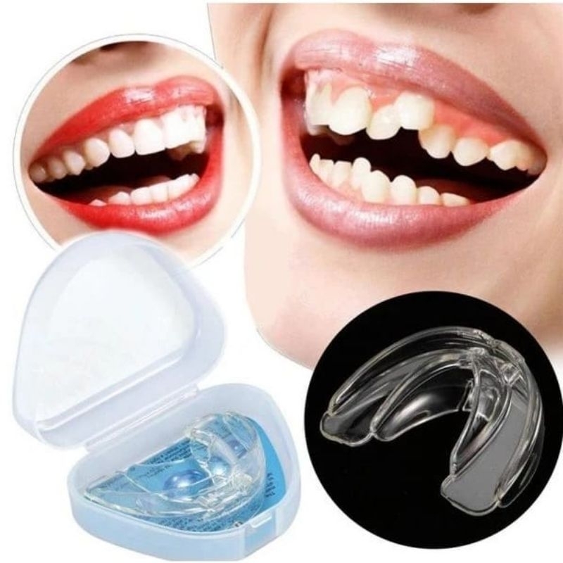 Jual {BG} PERAPI GIGI BEHEL TEETH TRAINER ALIGNMENT MERAPIHKAN TONGGOS ...