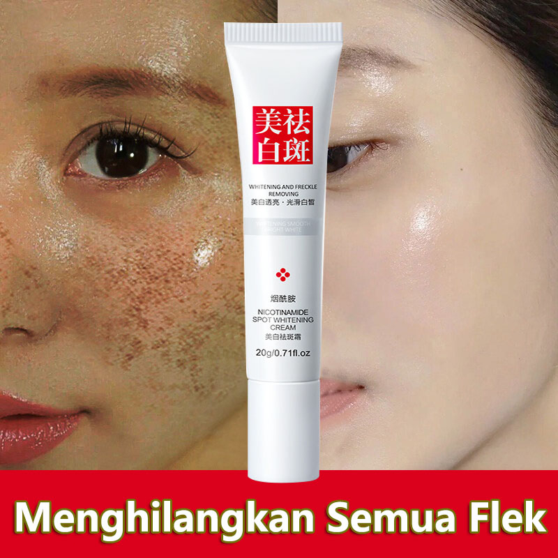 Jual SISKALEY Krim penghilang flek hitam Krim pemutih wajah Salep flek hitam membandel 20g ...