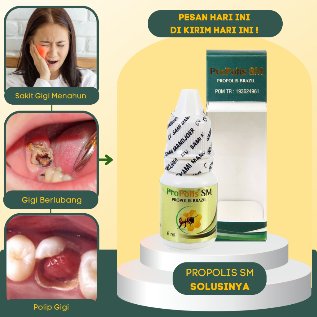 Jual Obat Sakit Gigi Berlubang, Gusi Bengkak, Gigi Ngilu Linu, Obat ...