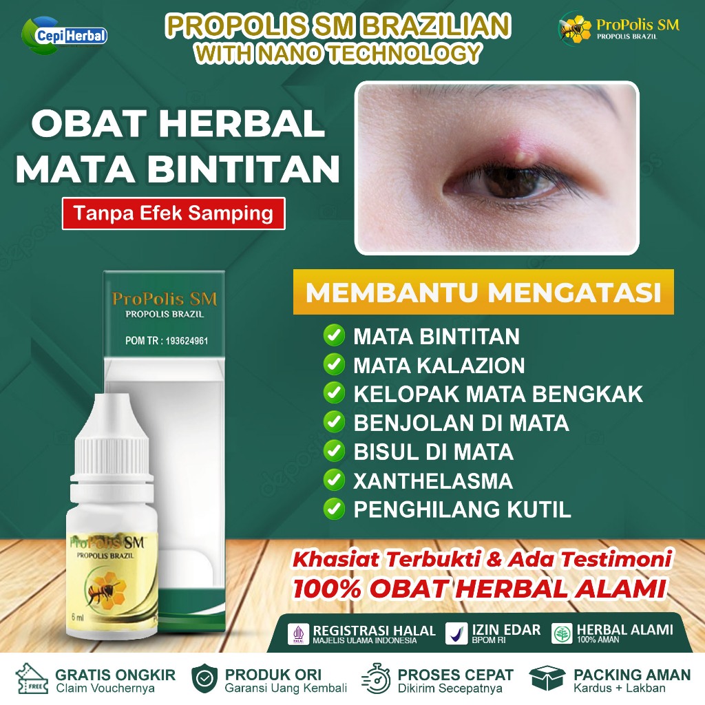 Jual Obat Mata Bintitan Kalazion Benjolan Di Kelopak Mata Timbilan ...