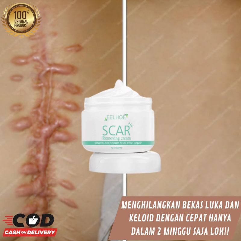 Jual Scar Cream Removal Krim Penghilang scar keloid bopeng bekas luka ...