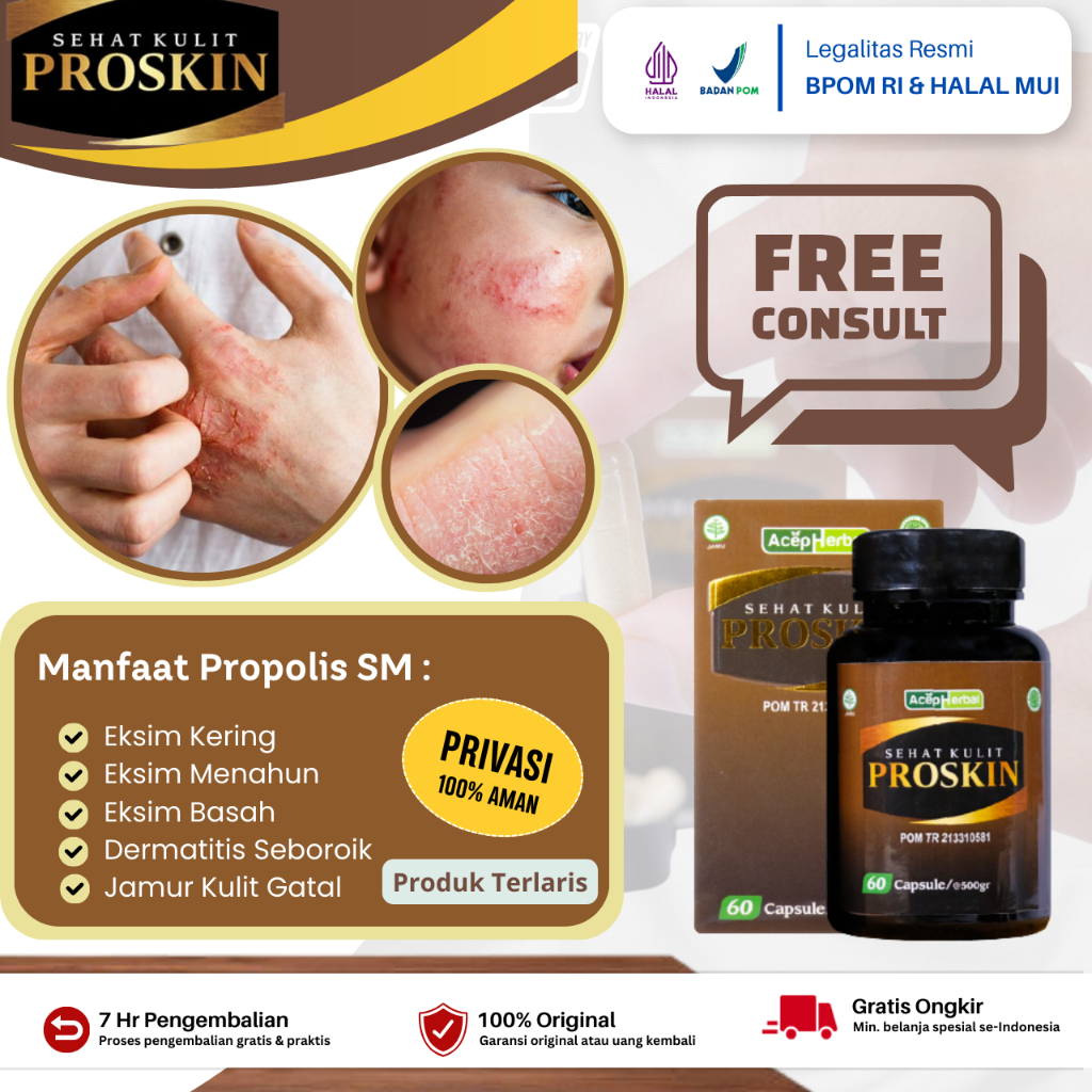 Jual Obat Eksim Kering - Obat Eksim Menahun - Obat Eksim Basah - Obat ...