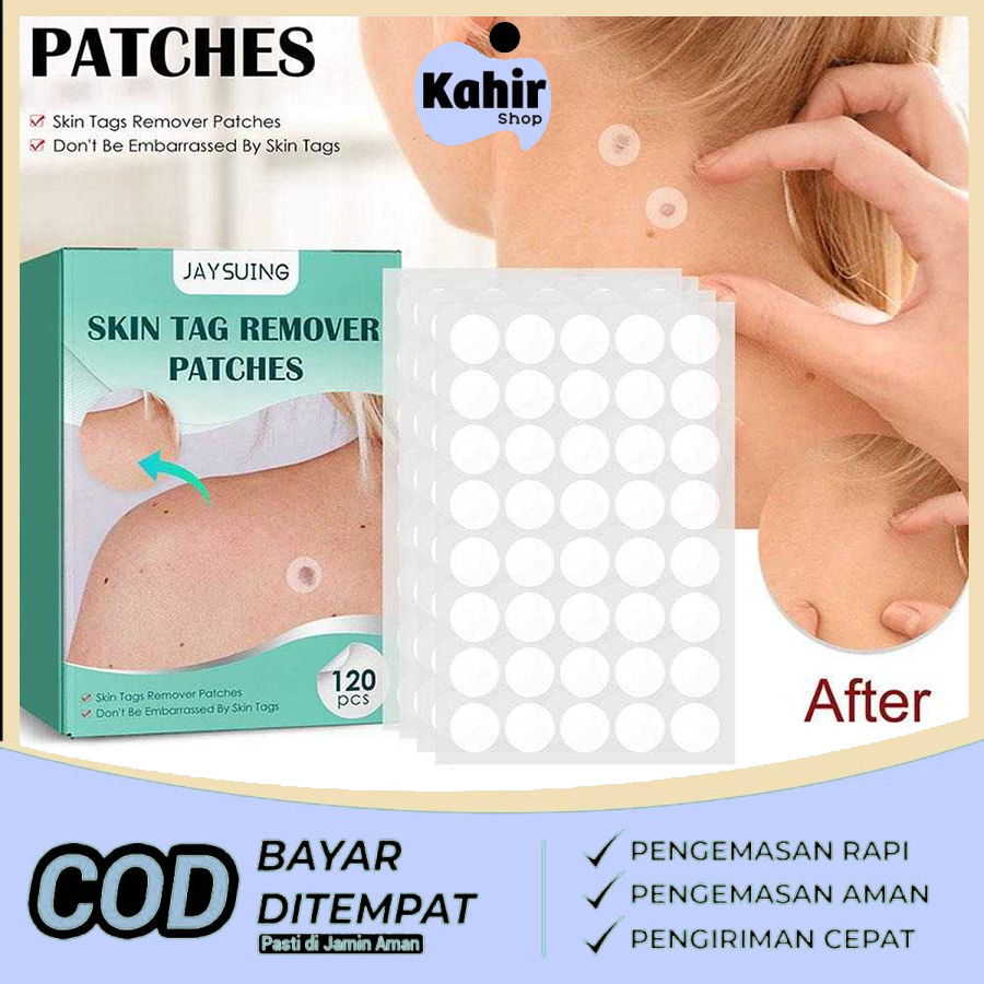Jual Stiker Penghilang Kutil & Tahi Lalat Tanpa Rasa Sakit Aman untuk ...