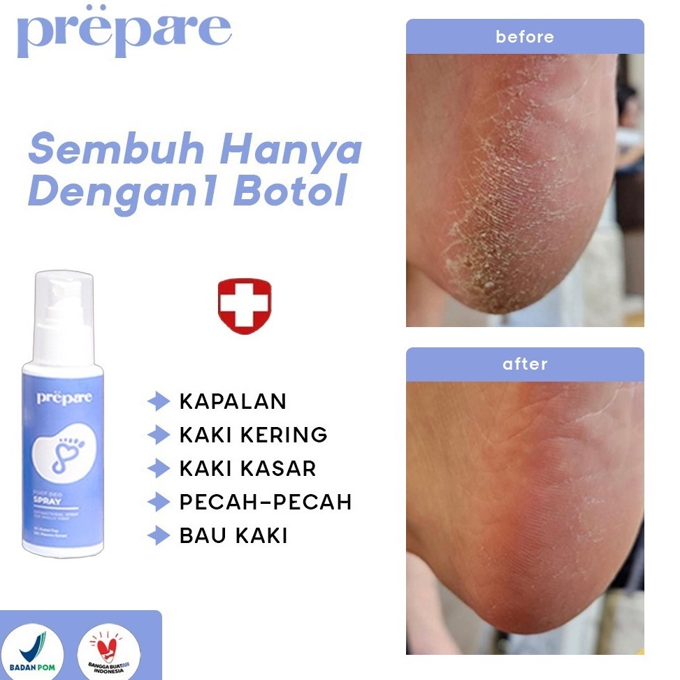 Jual ART Q34O PREPARE Foot Spray Penghilang Bau Kaki Obat Kapalan ...