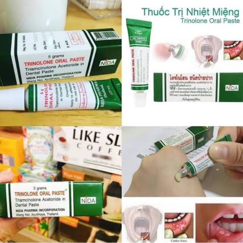 Jual Nida Trinolone Oral Dental Paste Salep Obat Sariawan Original ...