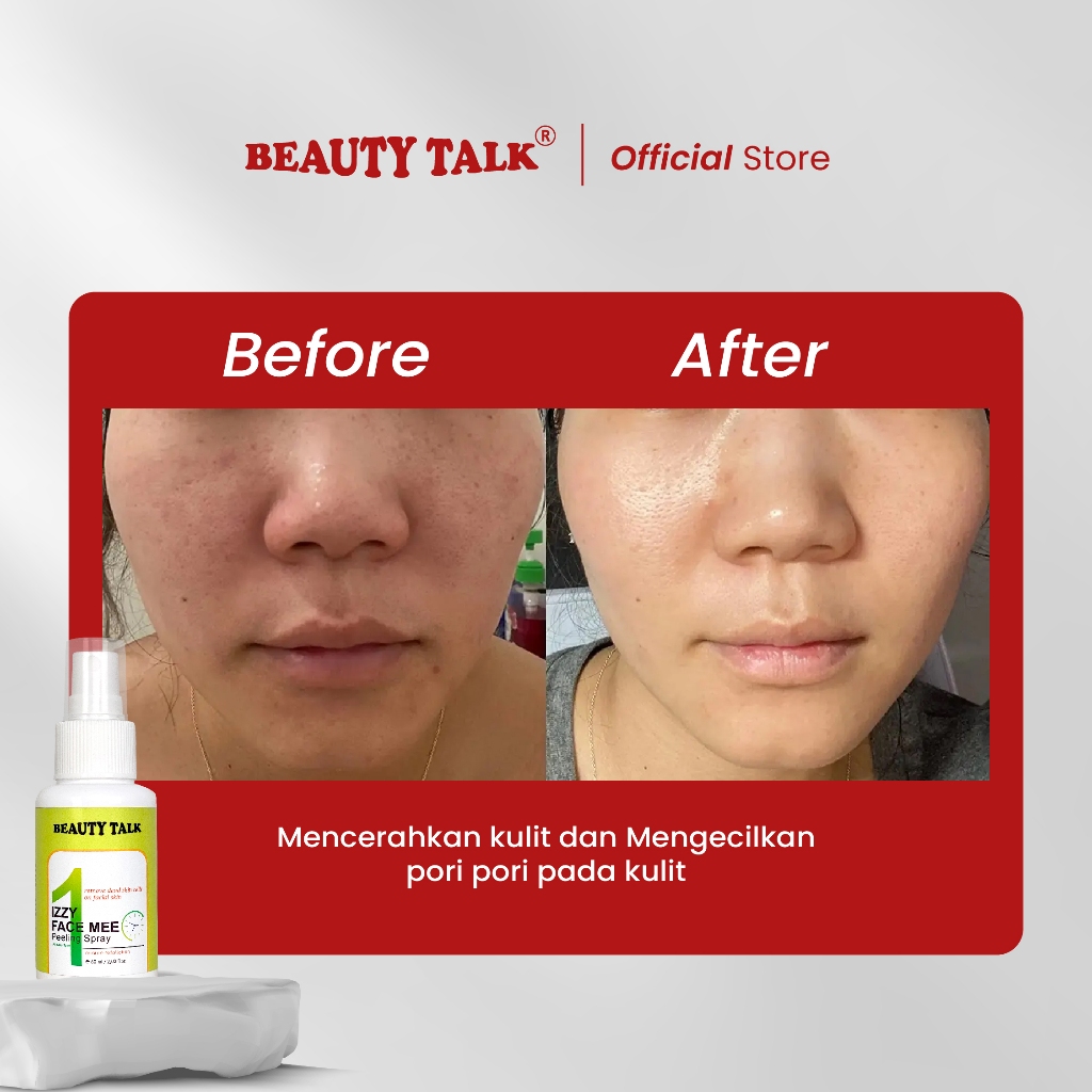 Jual BEAUTY TALK Izzy Face Mee Peeling Spray - 60ML | Pengangkat ...