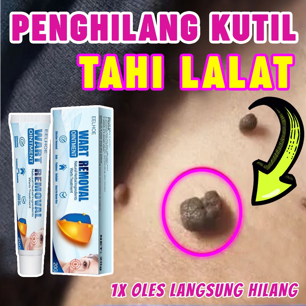 Jual Salep Obat Kutil Paling Ampuh【EELHOE】Pen Wart Remover Penghilang ...