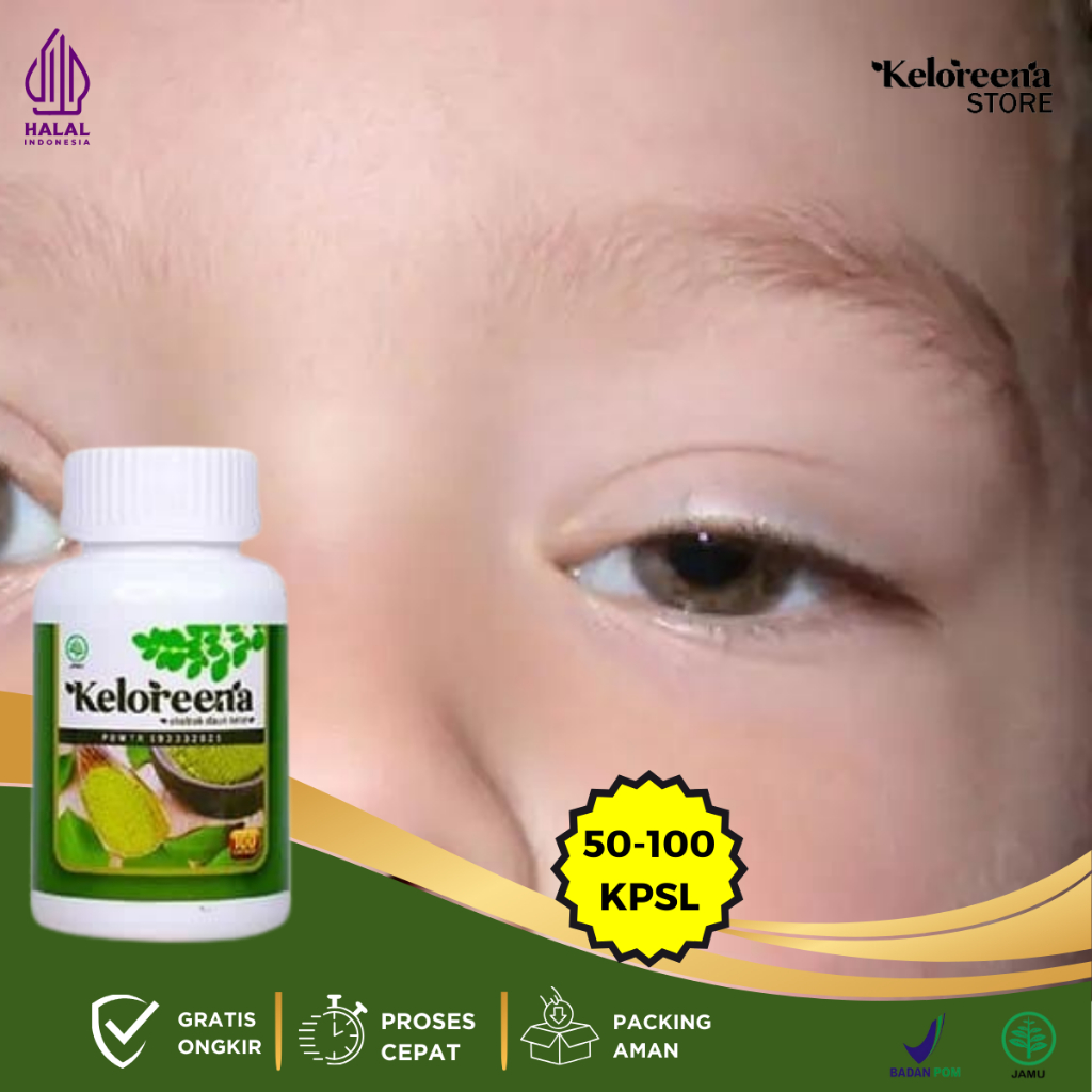 Jual Obat Mata Ptosis, Obat Kelopak Mata Turun Sebelah, Obat Lipatan ...