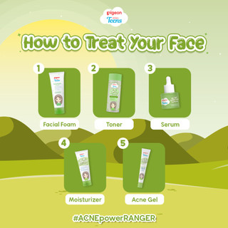 Jual PIGEON TEENS ACNE RANGER TONER 100ml | Toner Remaja | Kulit ...