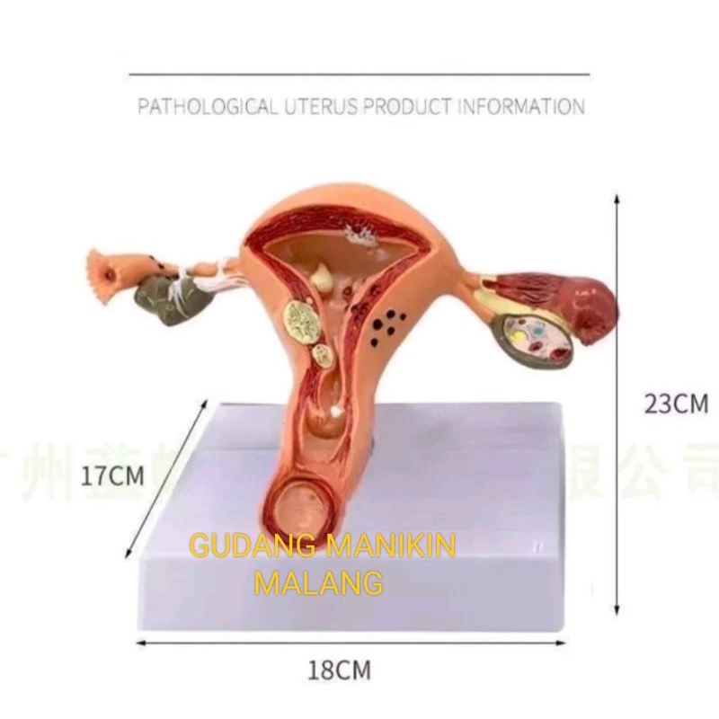 Jual UTERUS | UTERUS OVARY ANATOMICAL MODEL | PHANTOM/MANIKIN UTERUS | Shopee Indonesia