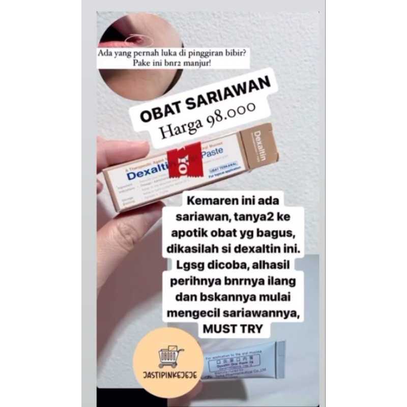 Jual obat sariawan dexaltin salep sariawan 2gr super bagus READY STOCK ...