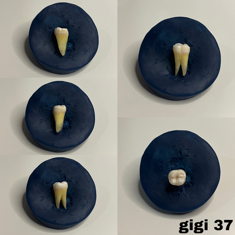 Jual Molar 1 2 3 bawah (gigi 36 37 38 46 47 48) graham asli praktikum ...