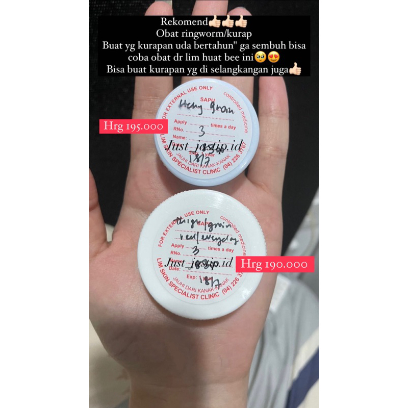 Jual Cream ringworm/kurap lim skin (PO PENANG) | Shopee Indonesia