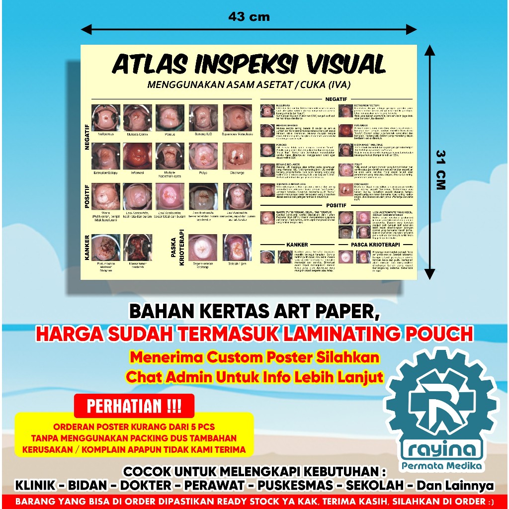 Jual Poster Kesehatan Inspeksi Visual | Shopee Indonesia