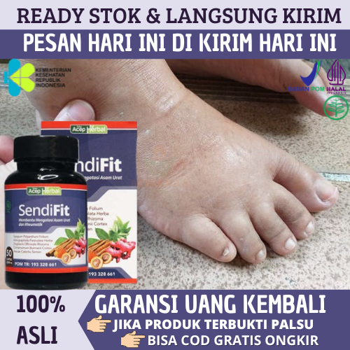 Jual Obat Herbal Kaki Bengkak Karena Asam Urat, Karena Penyakit ...