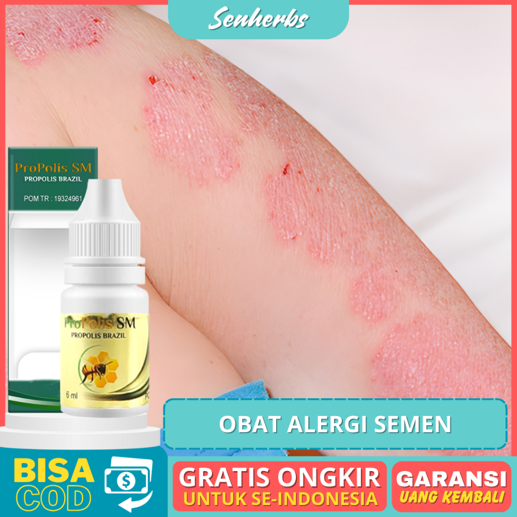 Jual Obat Alergi Semen, Obat Gatal Kulit Alergi Semen, Obat Oles Gatal ... Jual Obat Alergi Semen, Obat Gatal Kulit Alergi Semen, Obat Oles Gatal ...