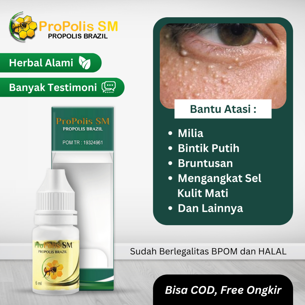 Jual Obat Milia - Milia Remover - Penghilang Milia - Milia Di Bawah ...