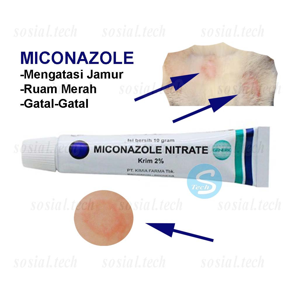 Jual Obat Jamur MICONAZOLE Ampuh / Salep Scabies / Ruam Merah Gatal ...