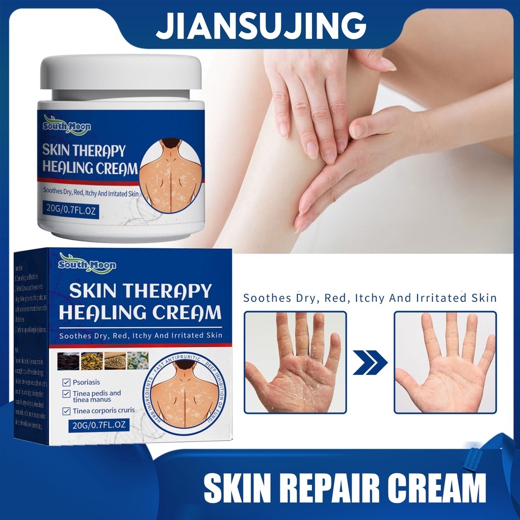 Jual South Moon Skin Therapy Healing SKIN ANTI ITCH CREAM Salep gatal ...