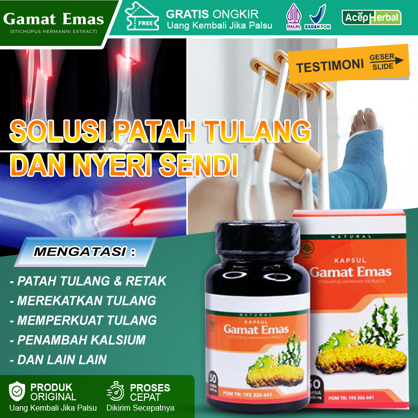 Jual Obat Patah Tulang Retak Remuk Penguat Tulang Dan Sendi Bergeser ...