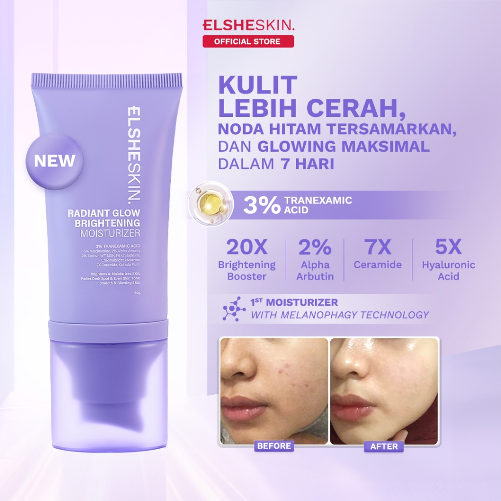 Jual [NEW LAUNCH] Elsheskin Radiant Glow Moisturizer - Skincare ...