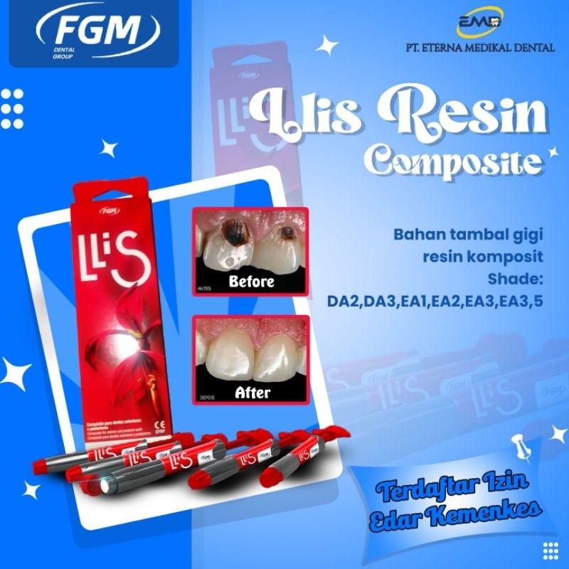 Jual Dental Composite / Resin Komposit universal / Tambalan Gigi Tetap ...