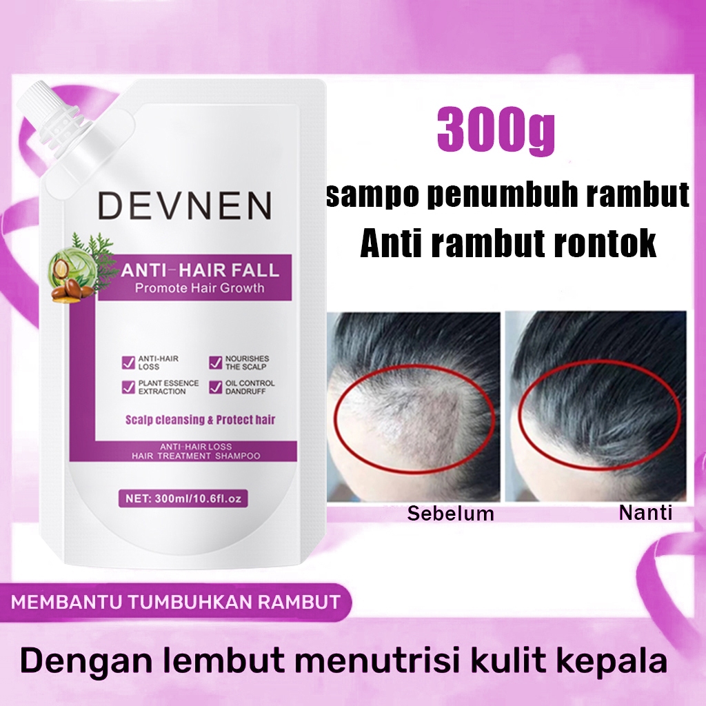 Jual 300ml Anti Rambut Rontok Ketombe Sampo Hair Growth Mengurangi ...