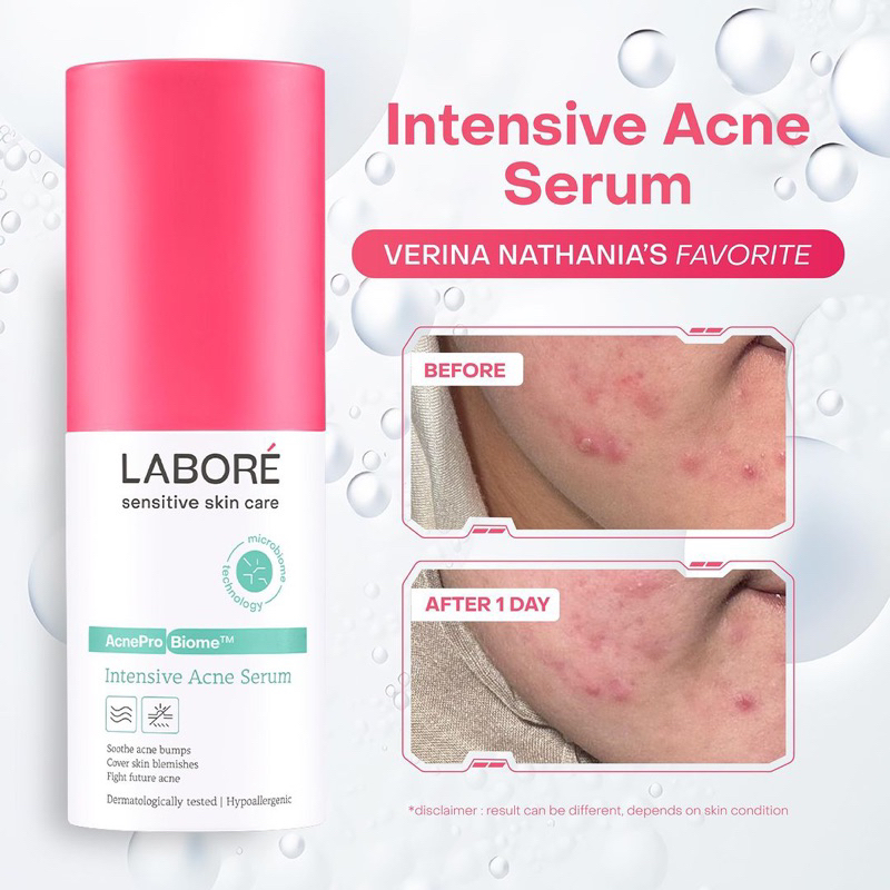 Jual DC LABORE Acnepro Biome Intensive Acne Serum (7ml 20ml) | Shopee ...