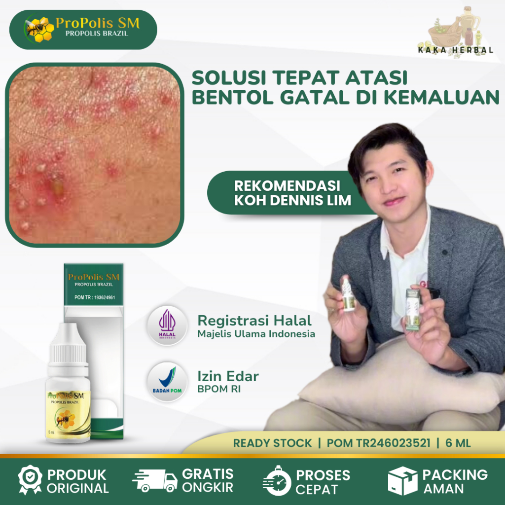 Jual Kaka Herbal - Obat Bentol Gatal Pada Area Kemaluan, Obat Bentol ...