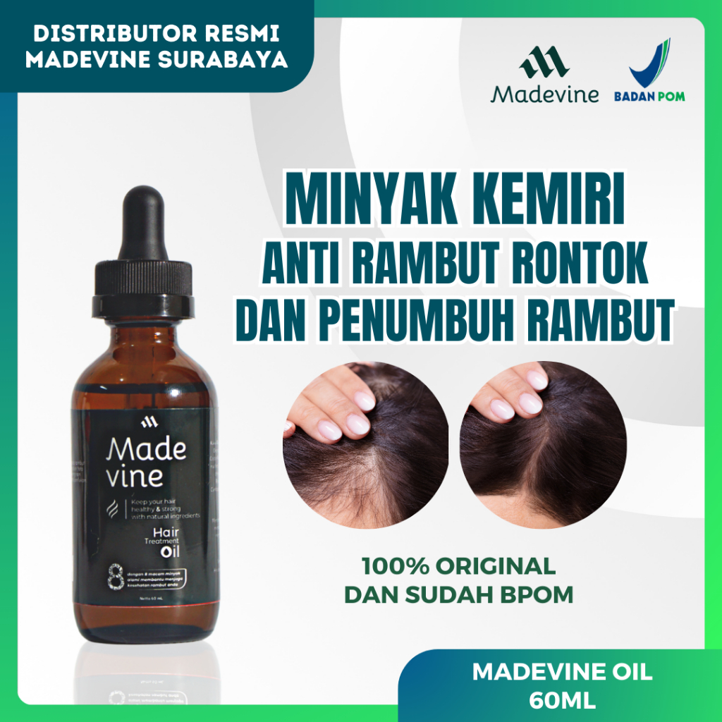 Jual MADEVINE OIL | Minyak Anti Rambut Rontok Untuk Pria & Wanita ...