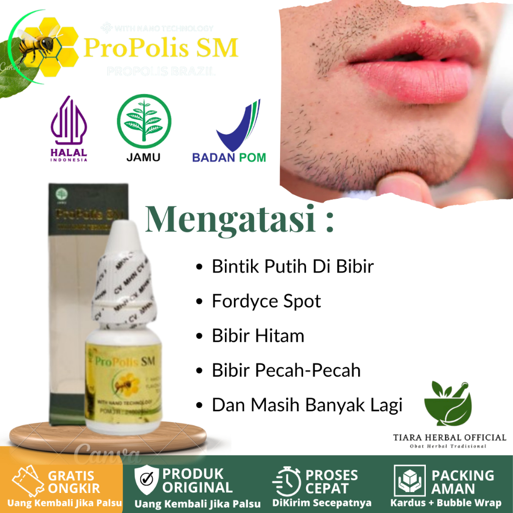 Jual ProPolis SM - Obat Oles Penghilang Bintik Putih Di Bibir Fordyce ...