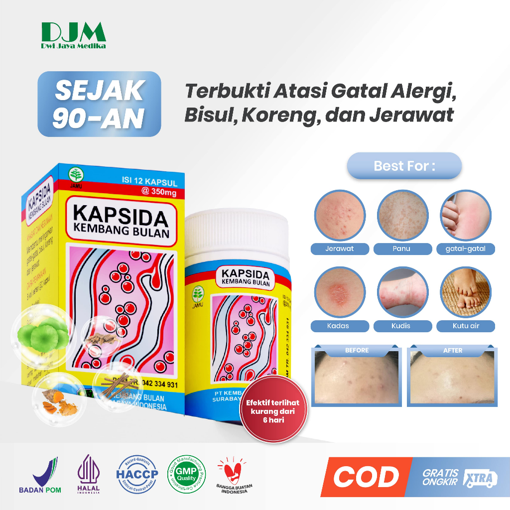 Jual KAPSIDA 12 Kapsul – Obat Jerawat, Gatal Alergi, Bisul, Koreng ...