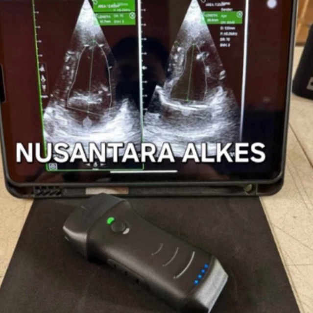 Jual Usg Wireless Konted C10TX Dual Probe Convex-Linier Color Doppler ...