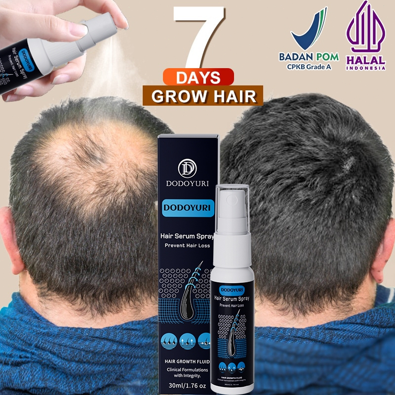 Jual Penumbuh rambut cepat permanen serum penumbuh rambut treatment ...