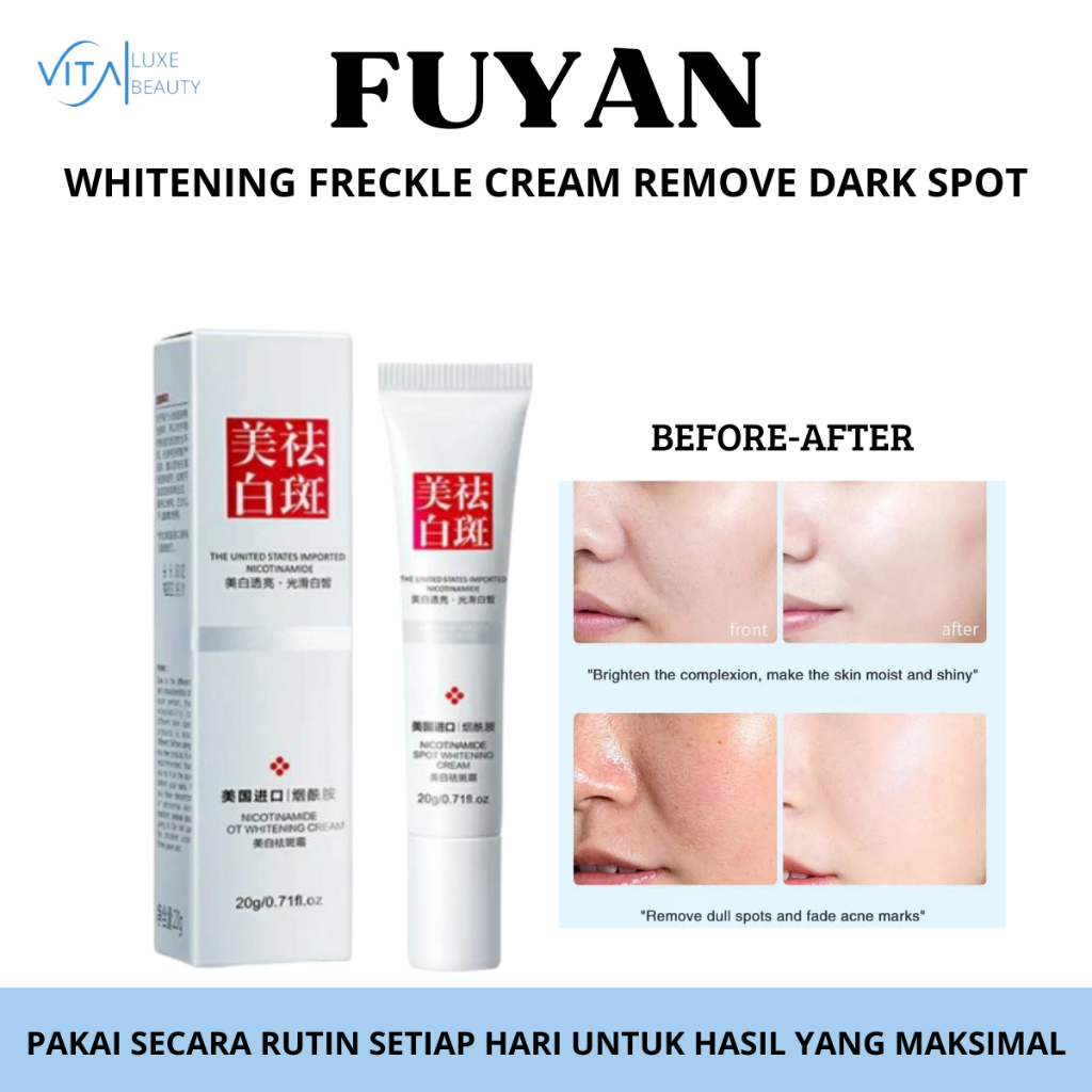 Jual FUYAN Whitening Freckle Cream Remove Dark Spots Anti Freckle Niacinamide Pelembab Flek ...